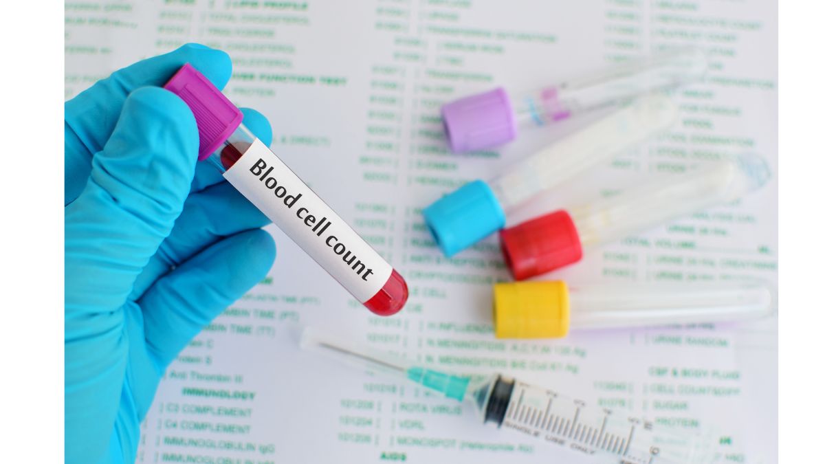 Dengue: How Bone-Breaking Fever Impacts Your Platelet Count And Ways To ...