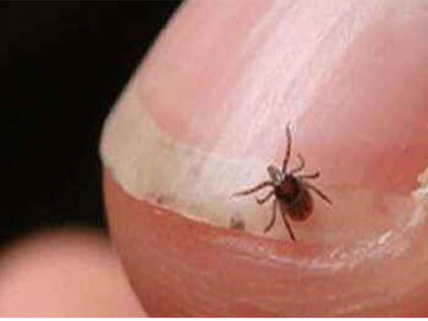 Odisha: Health Department On Alert After Scrub Typhus Kills 5 People