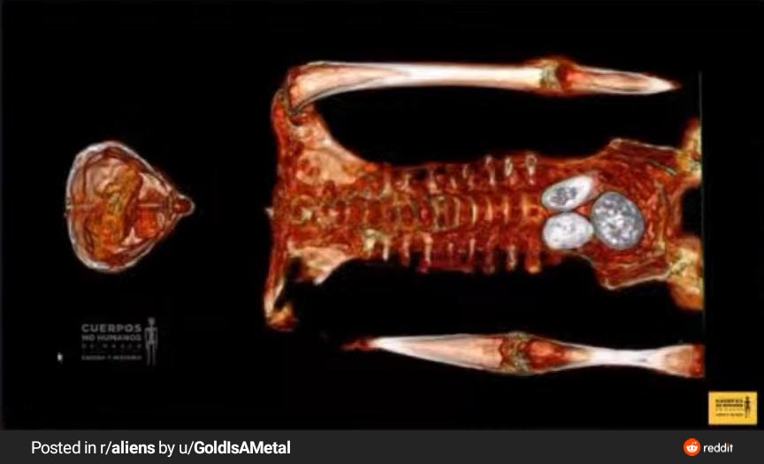 'Not Only Alive But Also Intact...': Mexican Navy Doctor Who Conducted ...