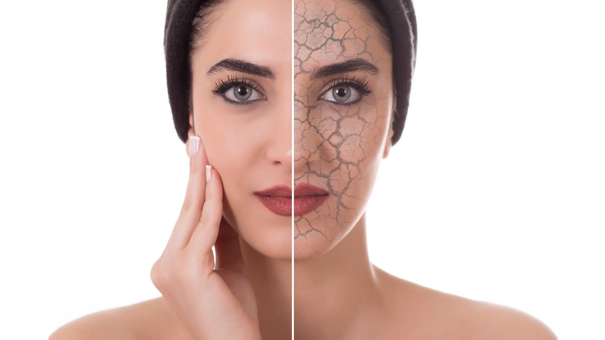 5 Signs That Your Skin Needs Your Immediate Attention; Dark Spots To Acne