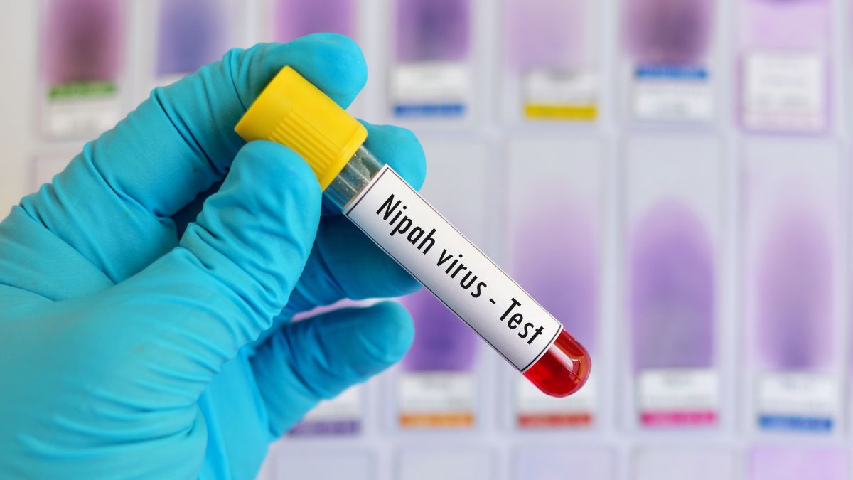 Nipah Virus Infection Confirmed In 14-Year-Old Boy In Malappuram ... Nipah Virus Infection Confirmed In 14-Year-Old Boy In Malappuram ...