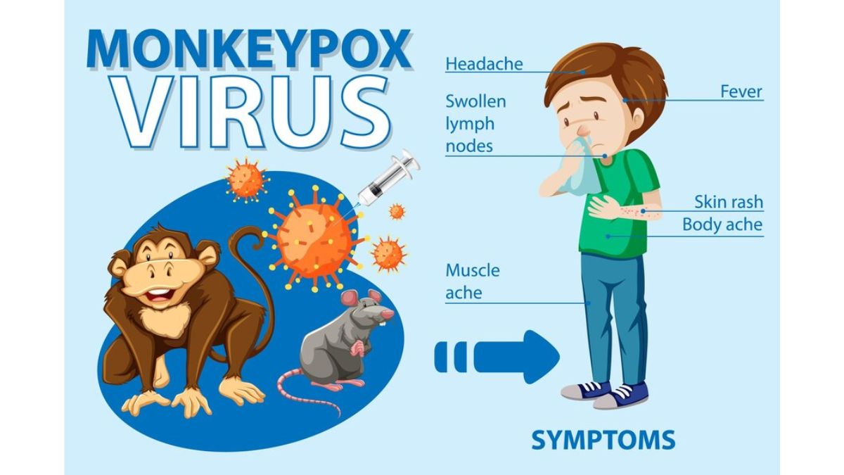 How Contagious Is Mpox Virus? Who Is At High Risk? Know Diagnosis And Treatment