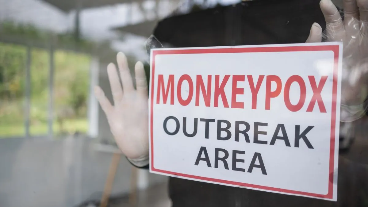 Monkeypox Treatment Guidelines Issued By AIIMS Delhi, Allocates Five ...