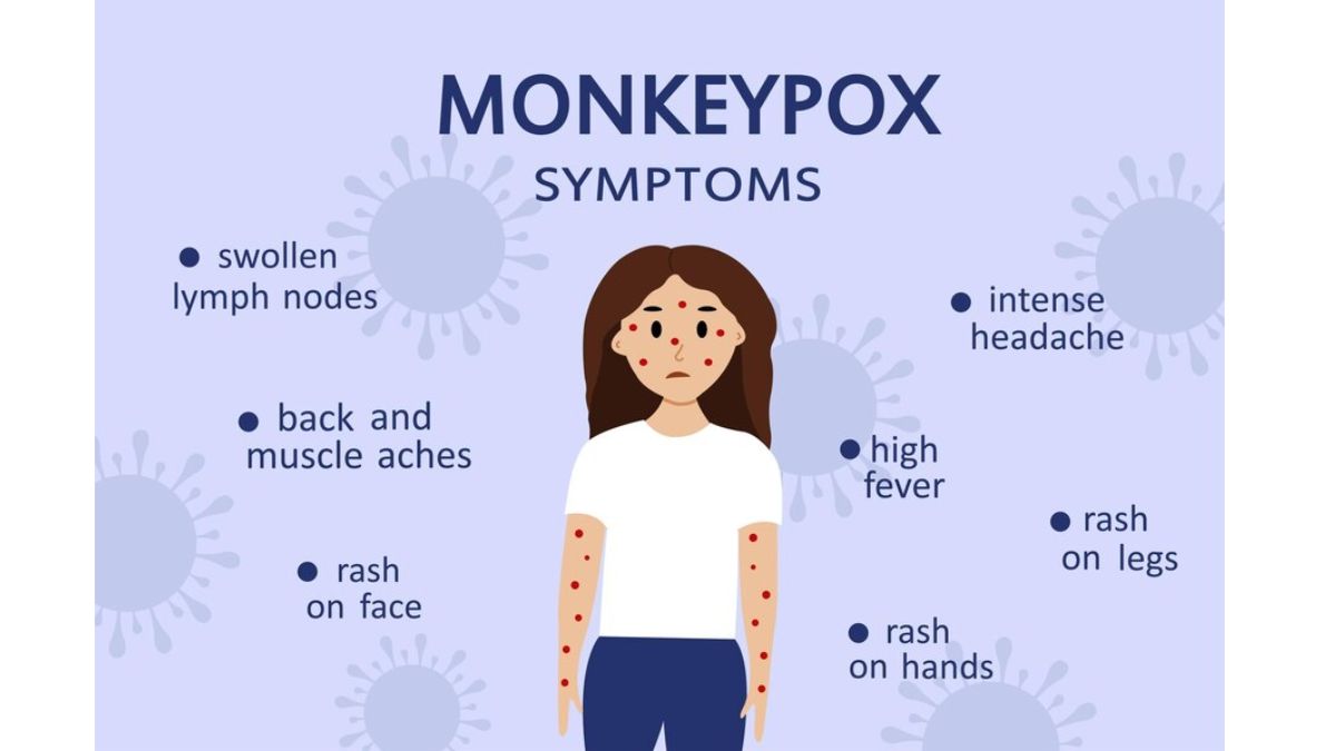 Mpox Outbreak: How Does It Spread From Person To Person? Expert Lists ...