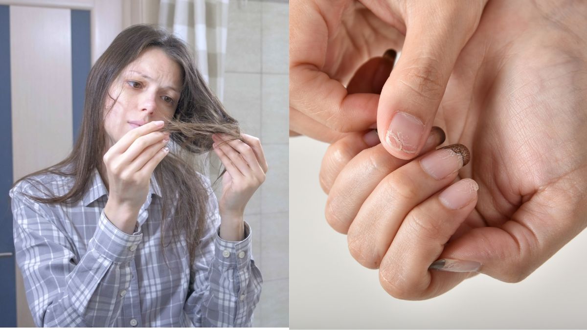 5 Signs Of Nutrient Deficiencies That You Should Never Ignore