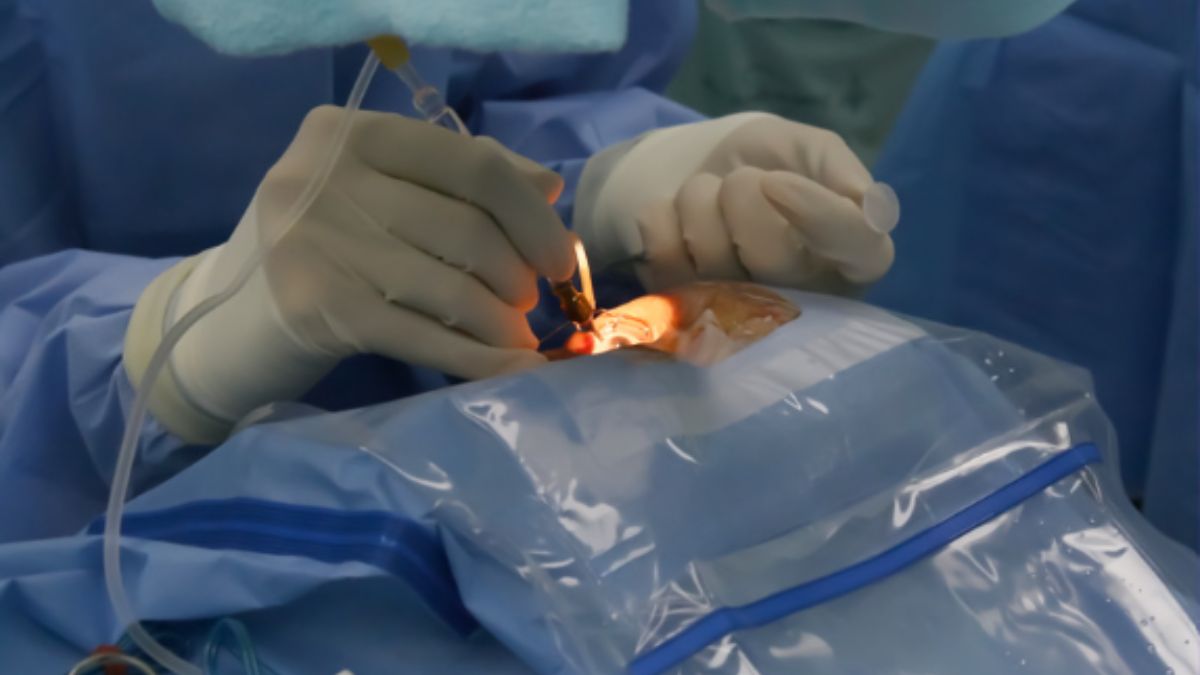 Greater Noida Doctor Performs Surgery On 7-Year-Old Boy's Wrong Eye ...