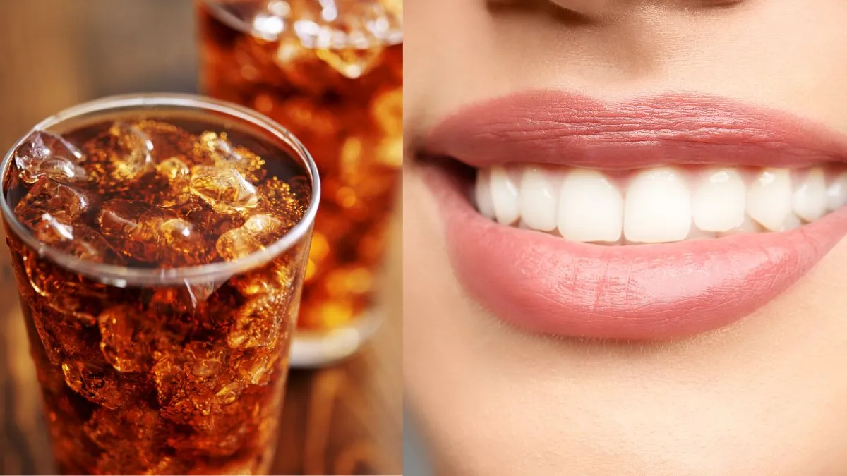 5 Foods And Drinks You Should Avoid For Healthy Teeth