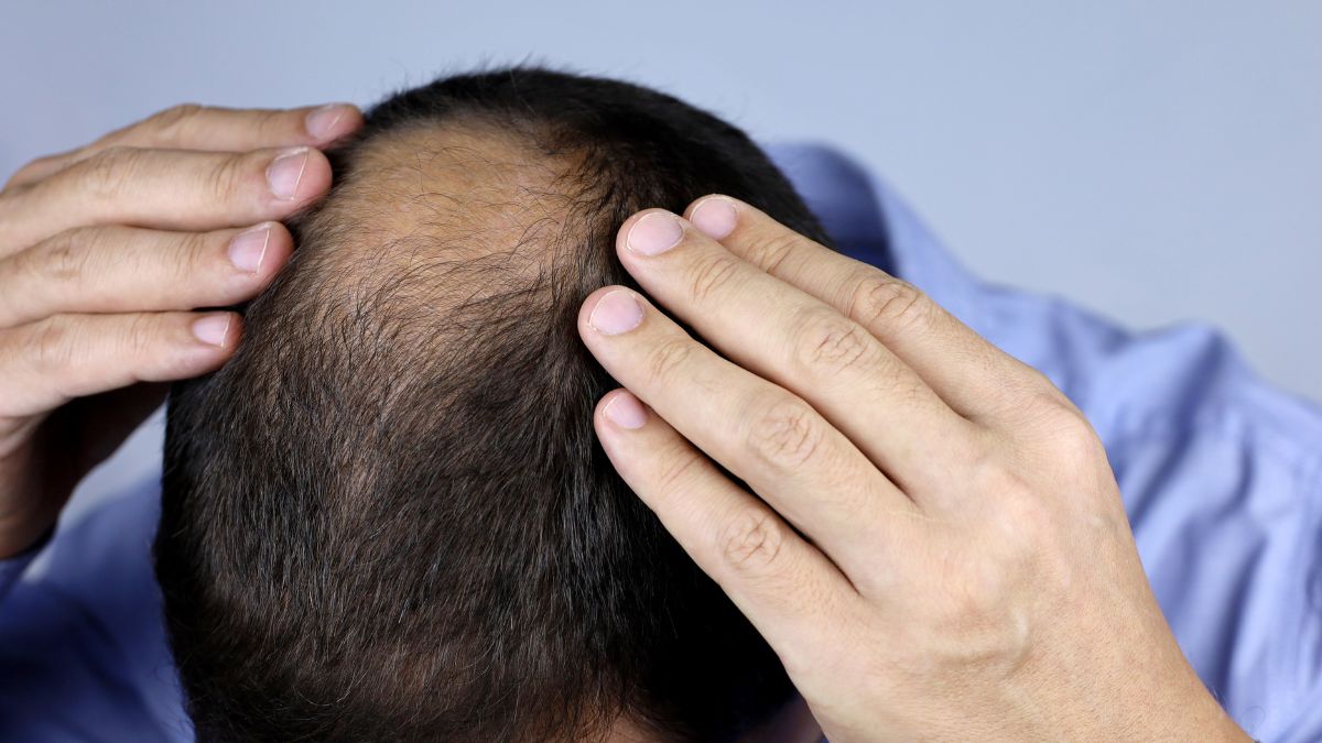 Maharashtra: Mass Hair Loss In Three Villages Sparks Panic As Residents ...
