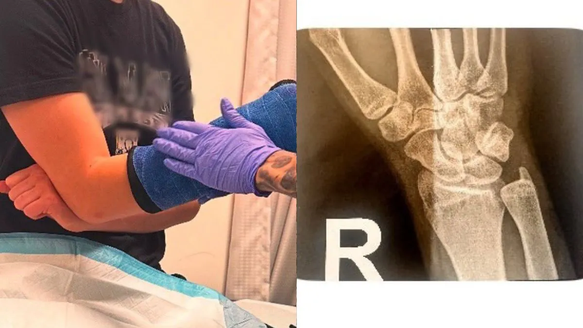 AI Ready To Replace Doctors? Woman Claims Elon Musk’s Grok Accurately ...