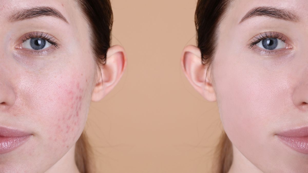 Dermatologist Approved Simple Tips For Dealing With Sensitive Skin