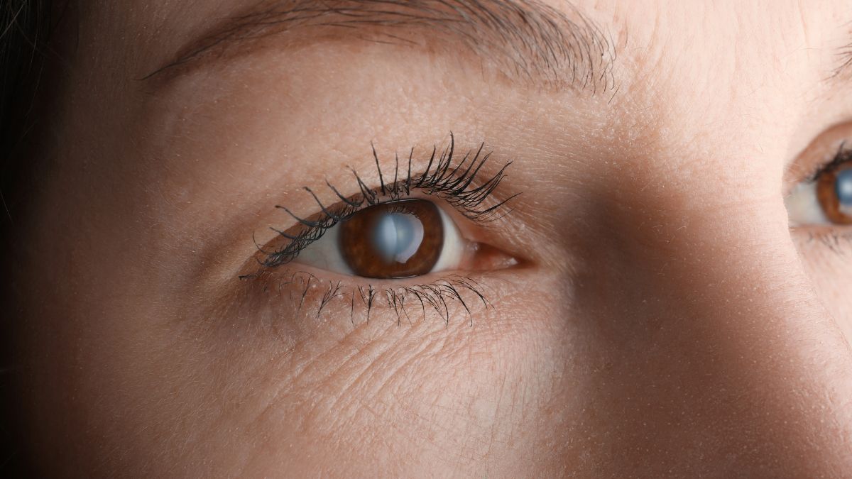 Doctor Lists 5 Eye Conditions You Need To Be Aware Of In Your 30s And 40s