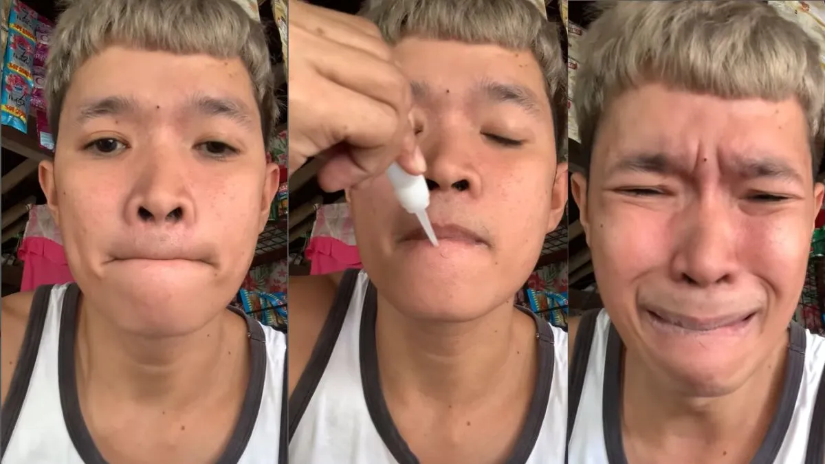 Boy’s Superglue Prank Goes Wrong Leaving Him Struggling With Sealed ...