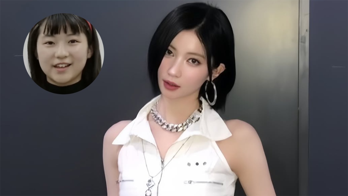 Did BABYMONSTER’s Asa Undergo Cosmetic Surgery? New Photos From Pre ...