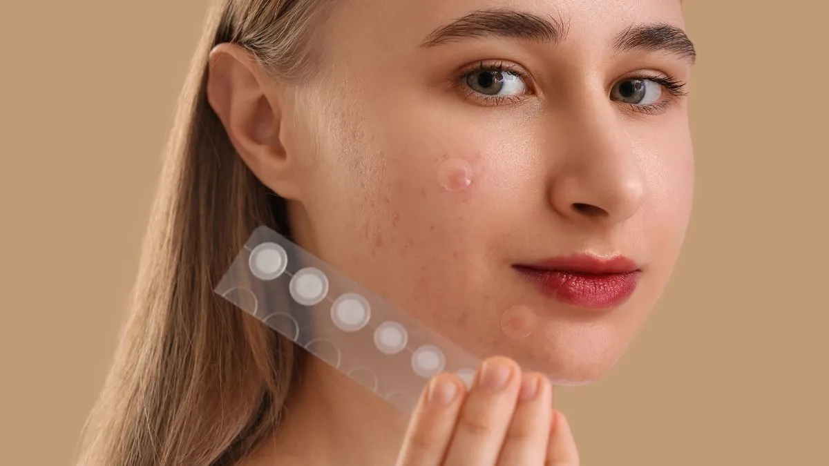 What Is Pimple Patch? Know The Benefits And Usage Of The Sticker That Fights Acne