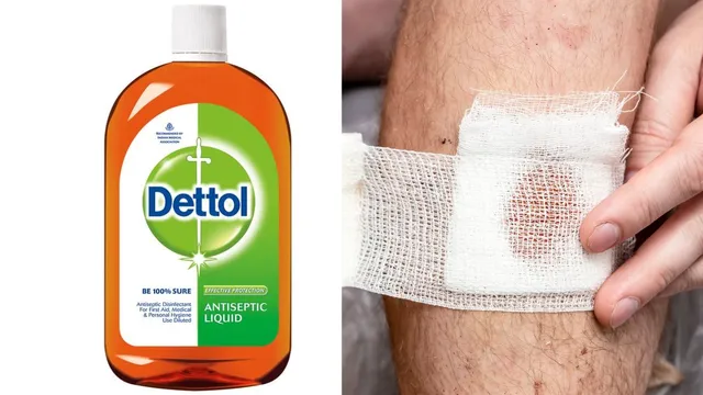 Is Dettol Safe To Use On Wounds? Antiseptic Company Clarifies After ...