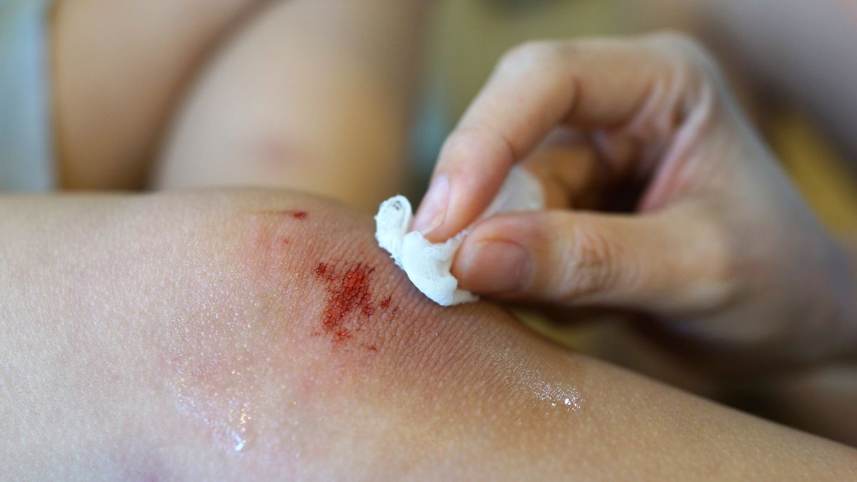 Is Dettol Safe To Use On Wounds? Antiseptic Company Clarifies After ...