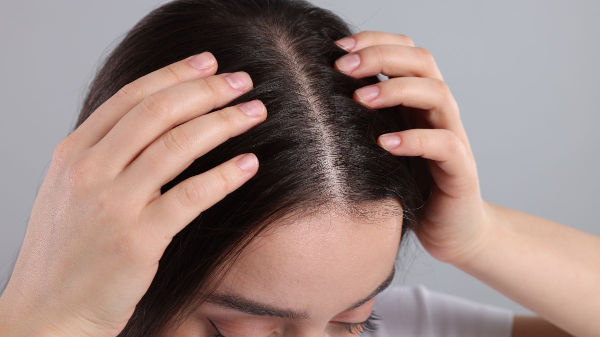 5 Effective Ways To Get Rid Of Sweaty Scalp In Summer At Home