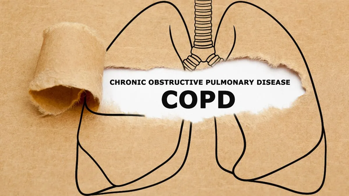 What Is Chronic Obstructive Pulmonary Disease? Doctor Shares Strategies ...