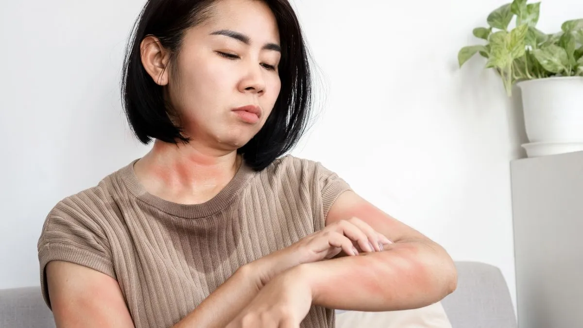 How Heat And UV Rays Trigger Skin Cancer And Exacerbate Psoriasis ...