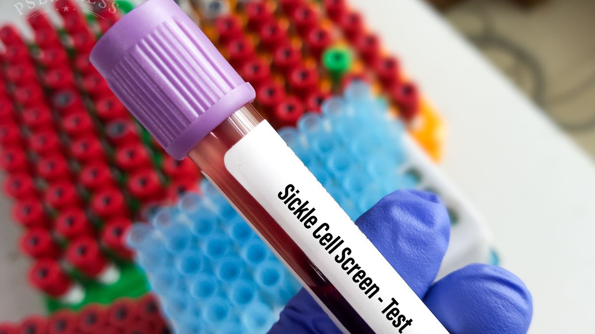 Doctor Shares 6 Things Everyone Should Know About Sickle Cell Disease