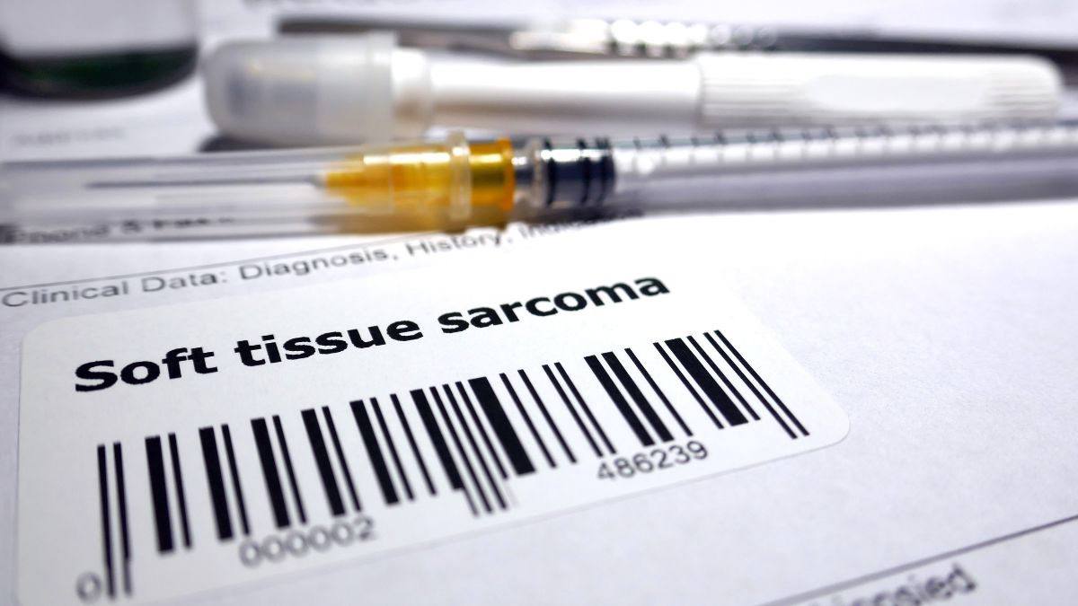 What Are The First Warning Signs Of Soft Tissue Sarcoma? Know From Doctor