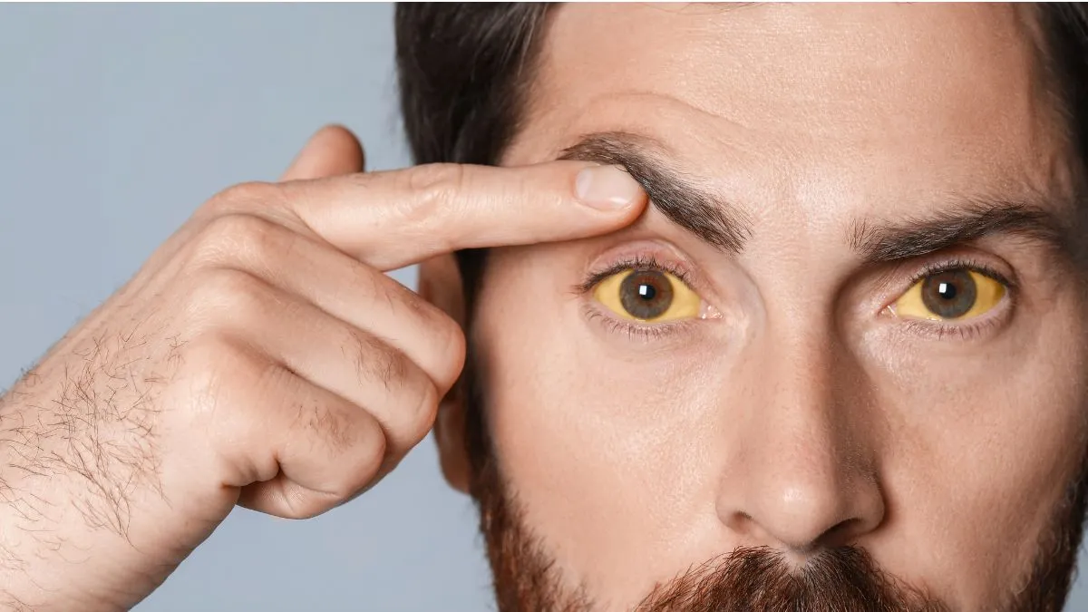What Are 7 Health Warning Signs Your Eyes Are Telling About You?