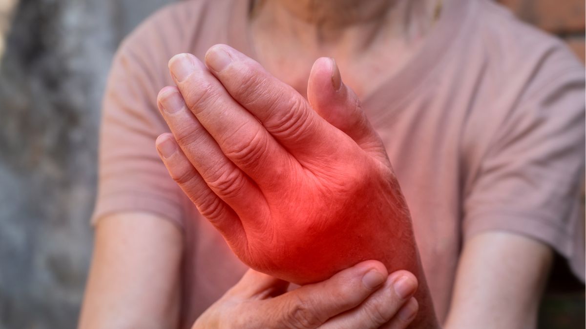 High Uric Acid? Watch Out For These 6 Telltale Signs In Your Hands And Feet