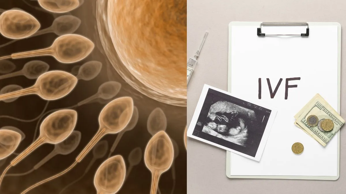 Male Infertility And IVF Failure: Doctor Explains The Sperm Quality ...