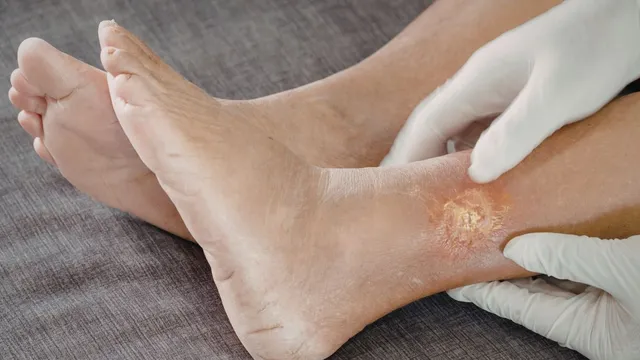 5 Alarming Signs Your Legs Show Before Heart Disease Or Diabetes ...