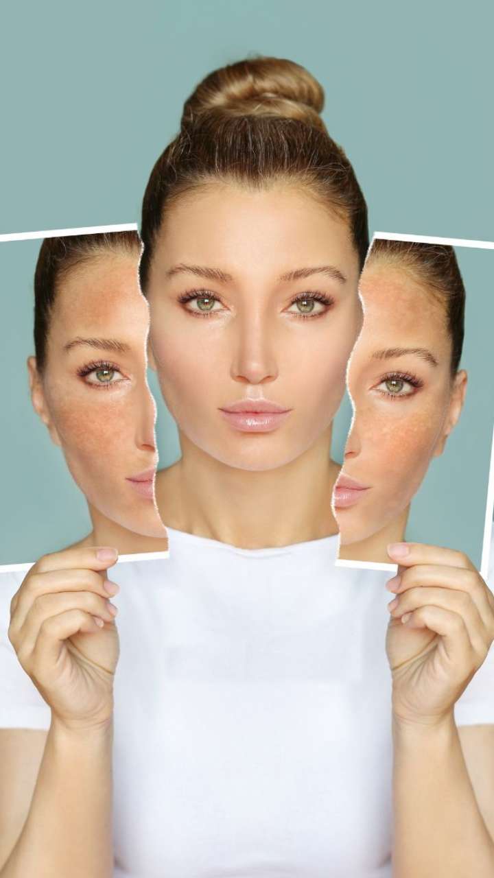 How To Identify Your Skin Type?